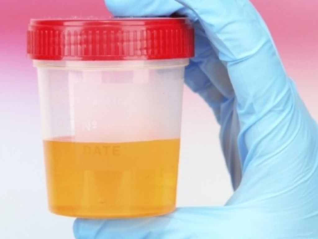 Sonhar com Urina - Sonhos.info